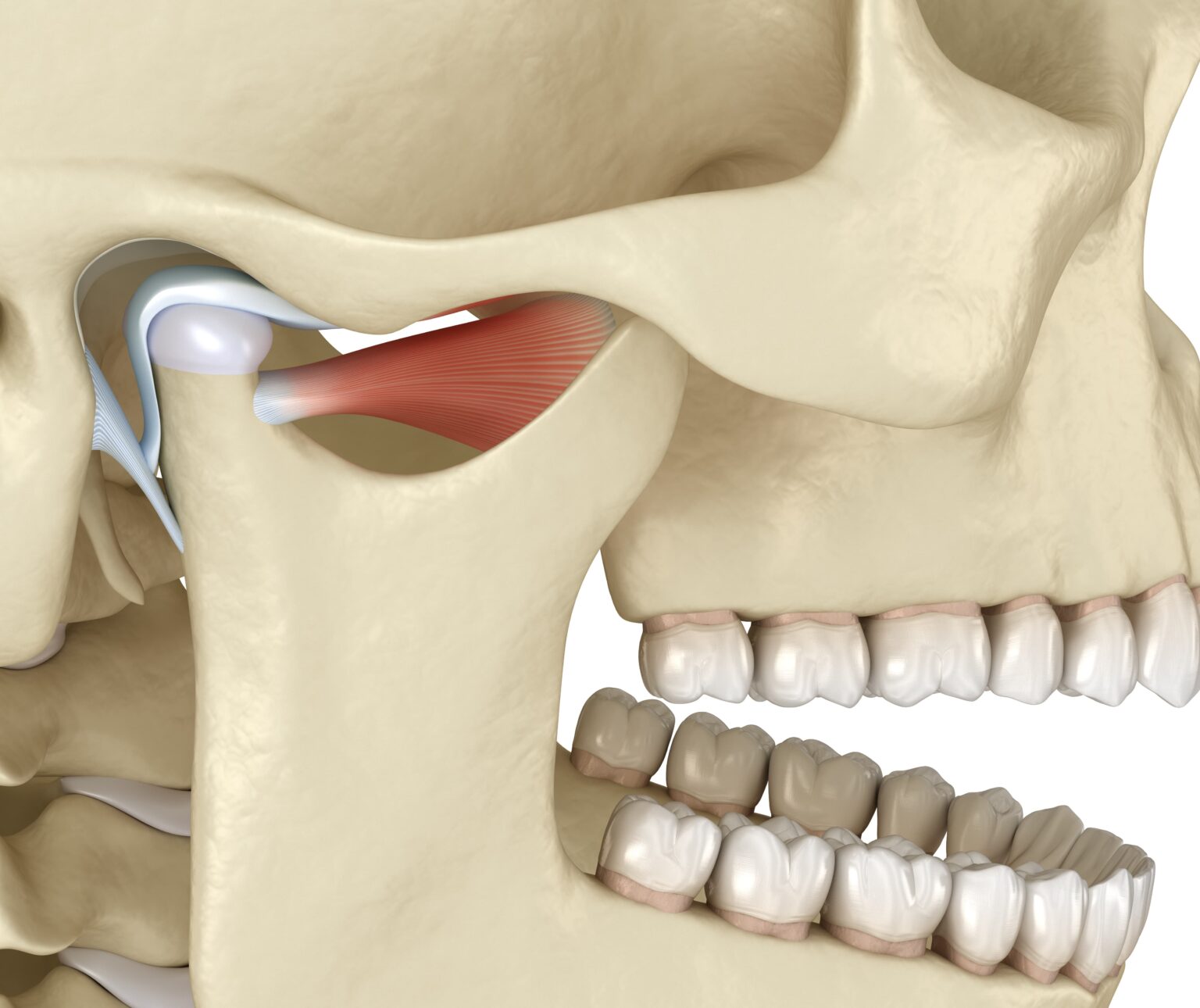 What is Lockjaw? | Princess Dental